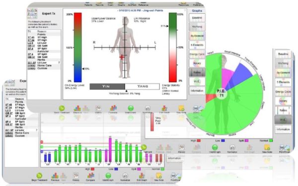 AcuGraph Acupuncture Technology | Elysian Wellness Centre