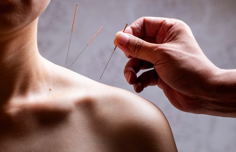 What to Expect During Your First Acupuncture Session | Elysian